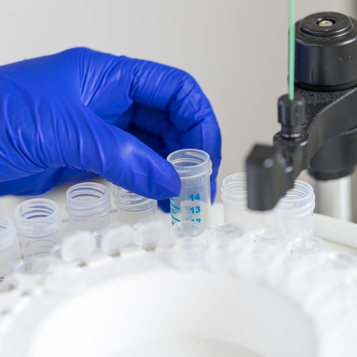 Maximizing Impact: Long-term Storage of Recombinant Antigens